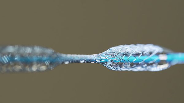 Stent Placement | Catholic Health - The Right Way To Care