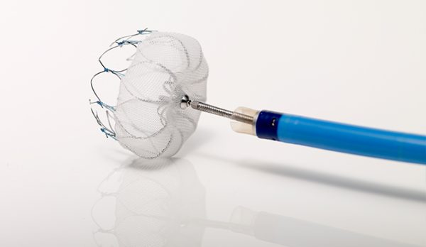 Left Atrial Appendage Closure Device | Catholic Health - The Right Way ...